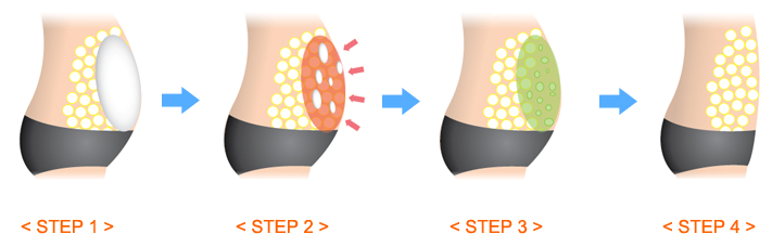 LIPOLAB (SLIMMING INJECTION)