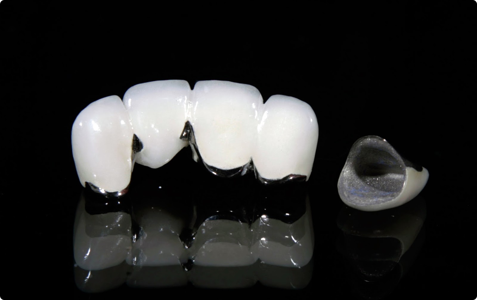 PFM Semi Precious - VC-TECH Dental Laboratory