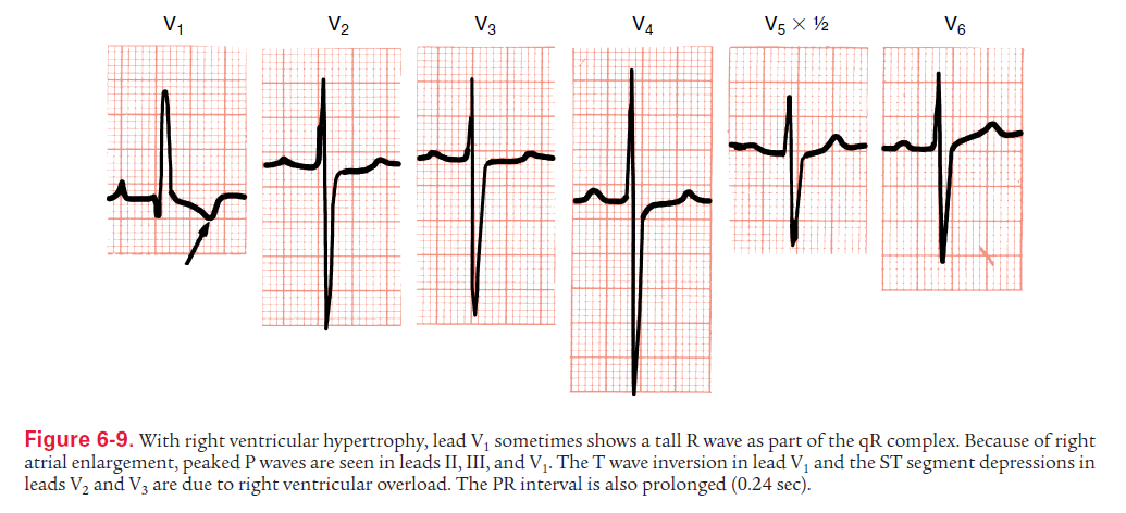 NOTA KEDOKTERAN: Interpretation of ECG (Introduction, Chambers ...
