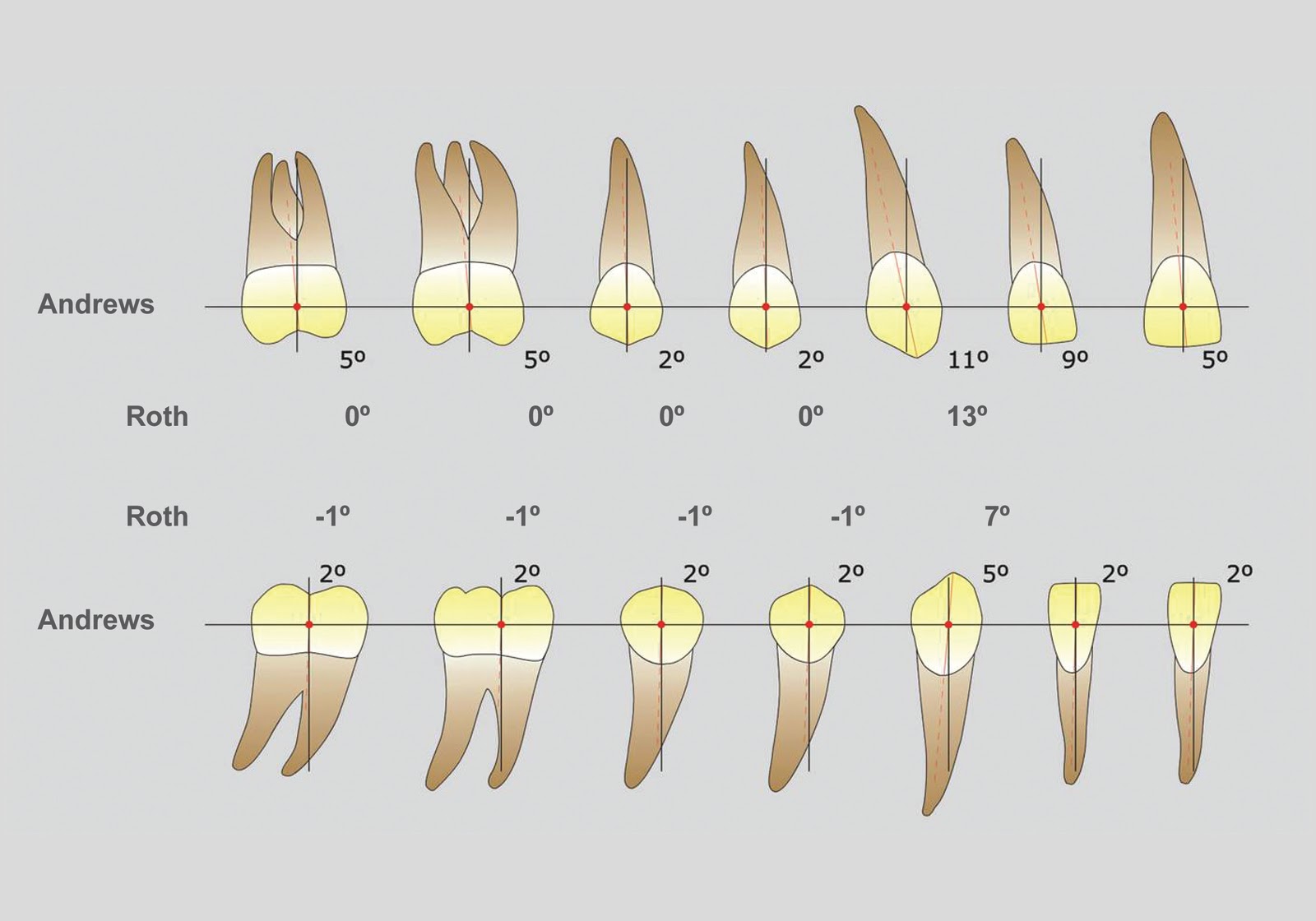OdontoBlog: LAS SEIS LLAVES DE LA OCLUSIÓN NORMAL DE ANDREWS