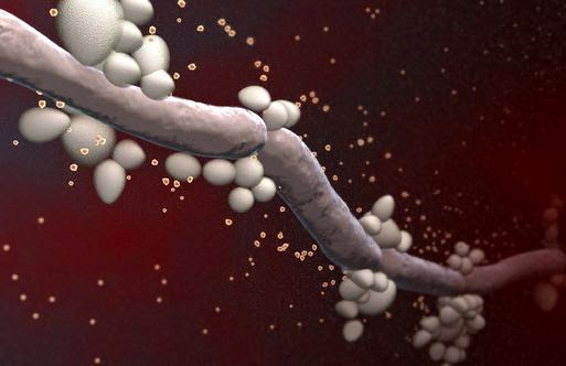 Conoce 4 Formas de Infección por Candidiasis