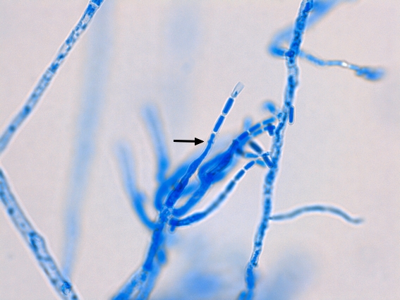 Fun With Microbiology (What's Buggin' You?): Arthrographis species