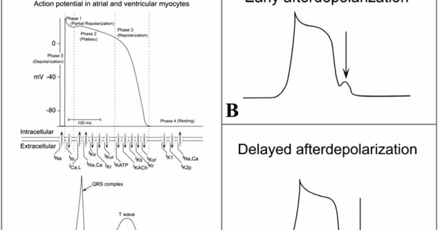 Dr Han Naung @ Henry Han : Electrophysiology and Heart Rhythm ...