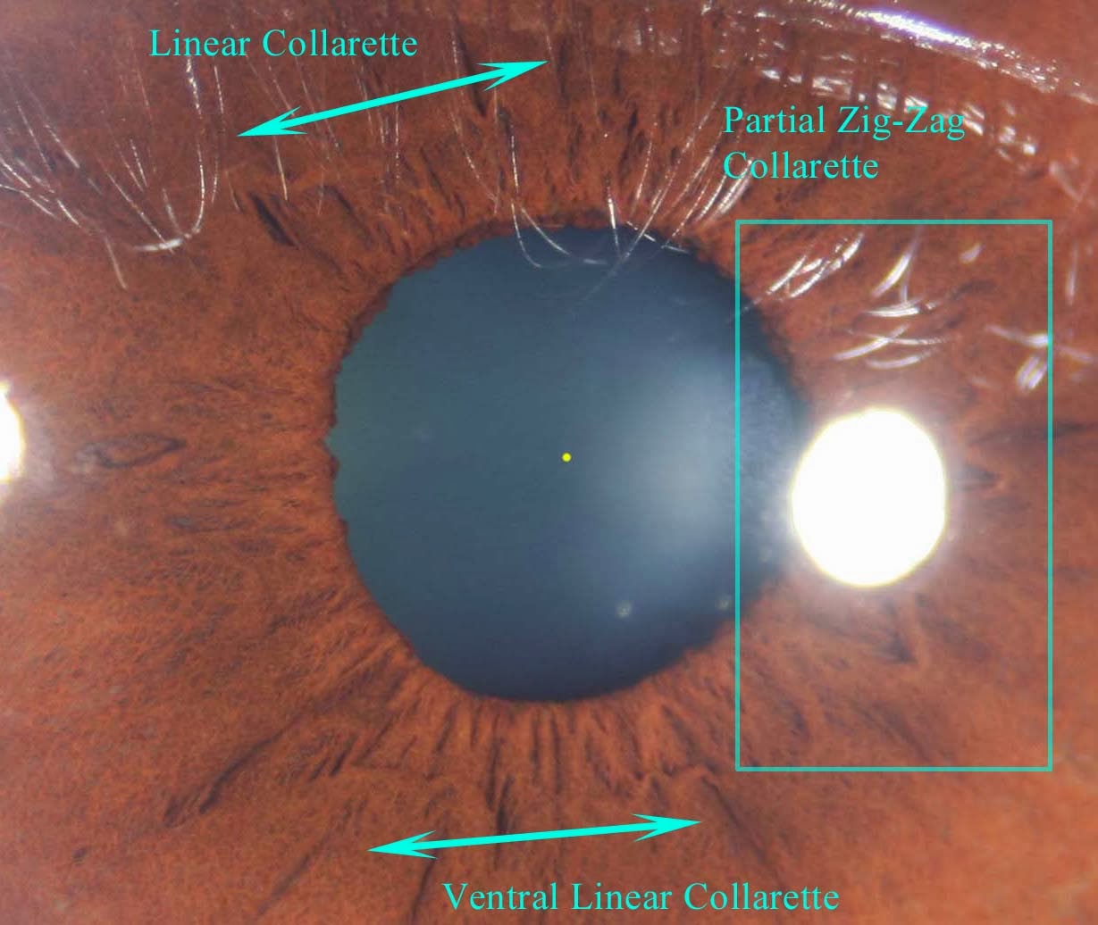 Modern & Multidimensional Iridology: The Important Iris Signs - Lx - (vasu)