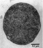 madressilva: Euriarqueotas