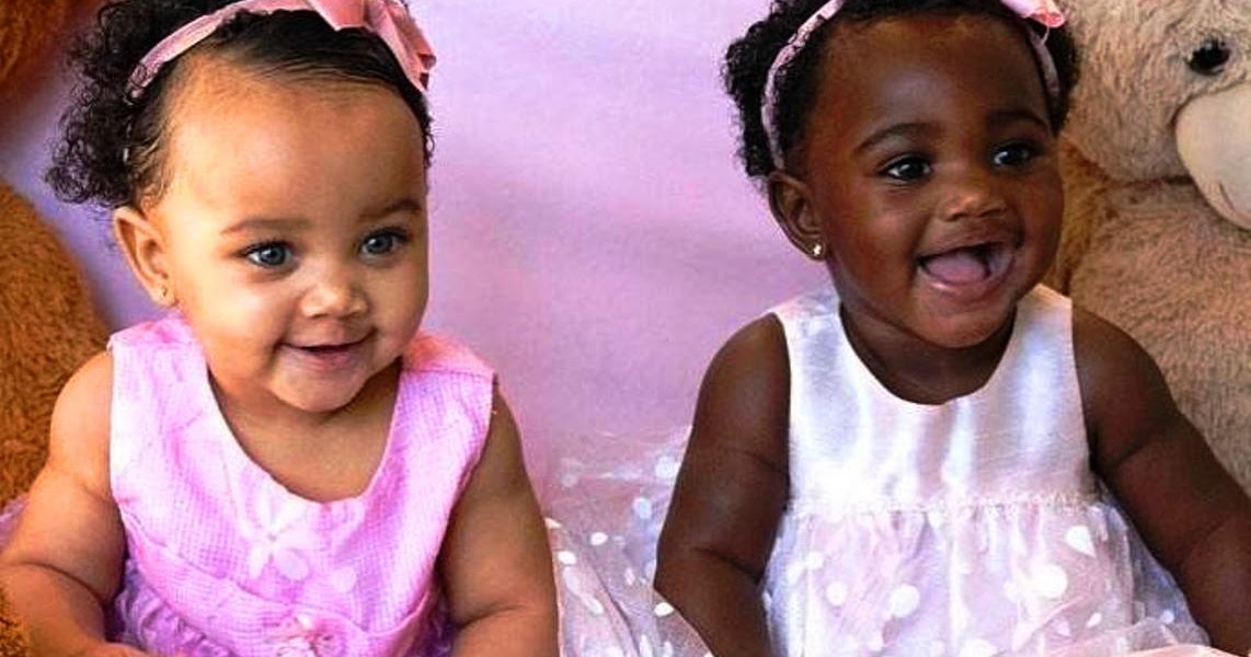 Naturalizate Ya: Gemelas nacen con distinto color de piel, ¿cómo es posible?