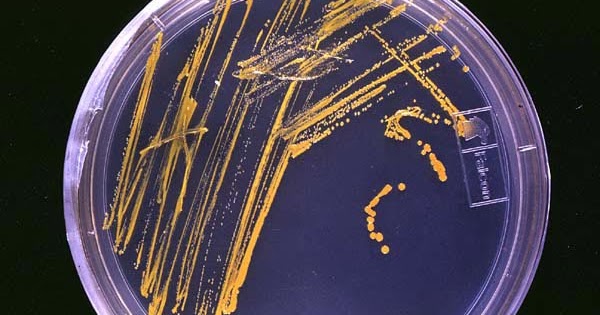 Microbiology Lecture Notes - SET 4