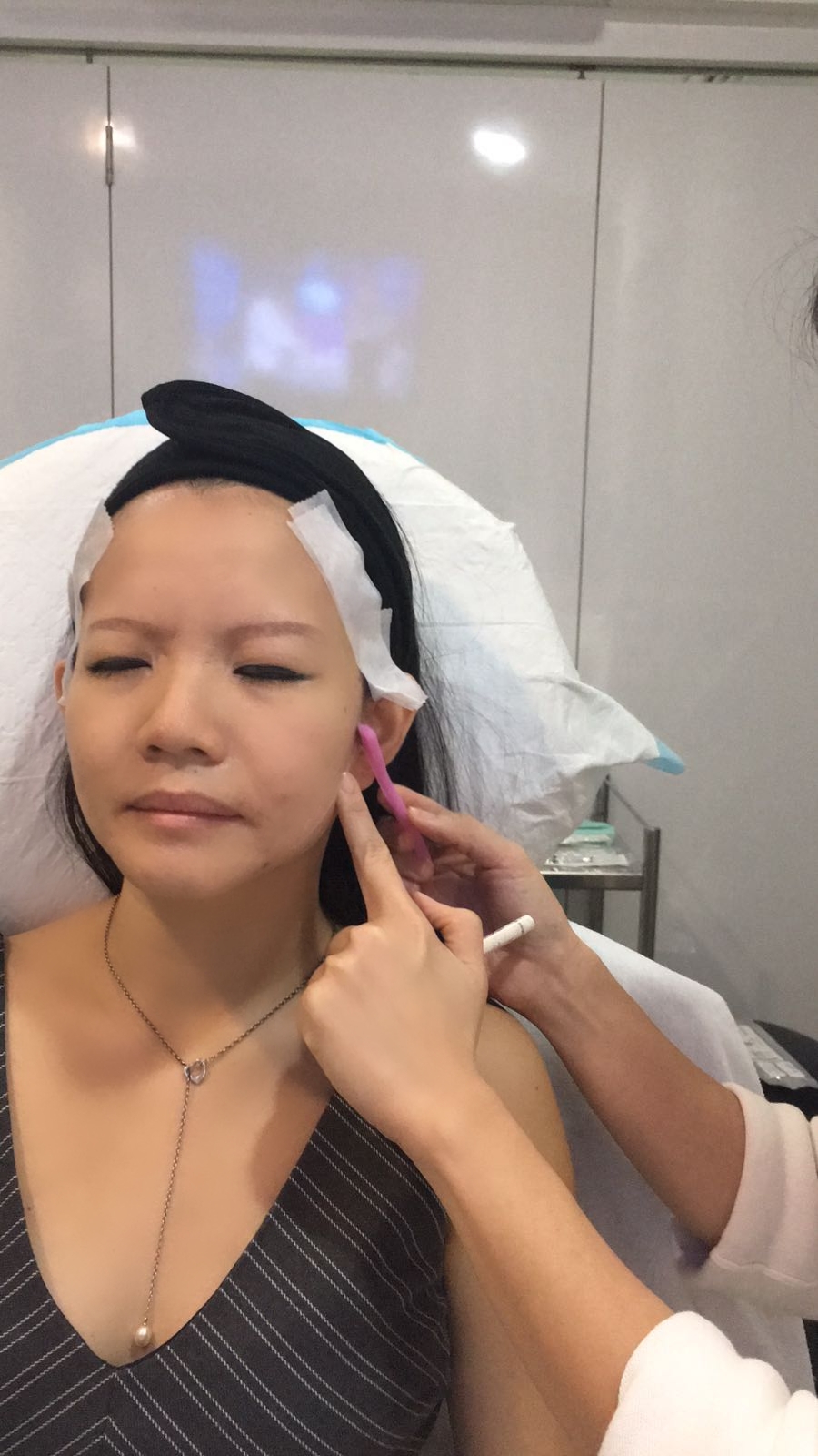 TheArcticStar's Tales: Review on Happy Lift Threadlift Procedure @ EHA ...