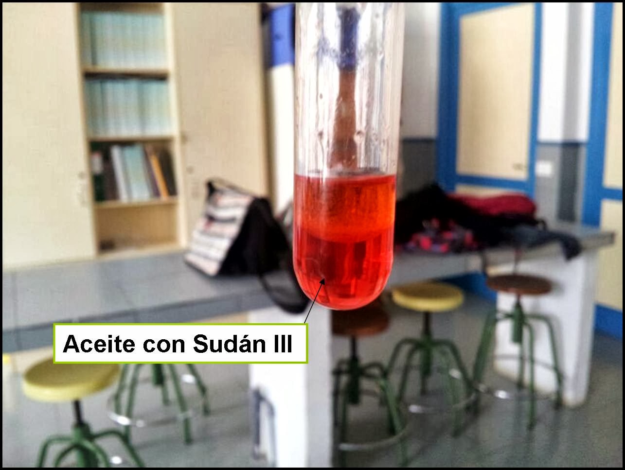 Biología humana: Prueba C. Lípidos. Análisis mediante el reactivo de Sudan III.