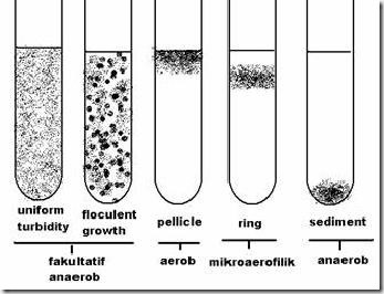 Praktikum Mikrobiologi (Pembuatan Medium Dan Kulturisasi dari Isolat ...