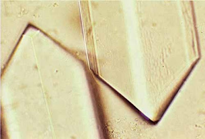 Atlas of Crystals found in alkaline urine | Free Medical Atlas