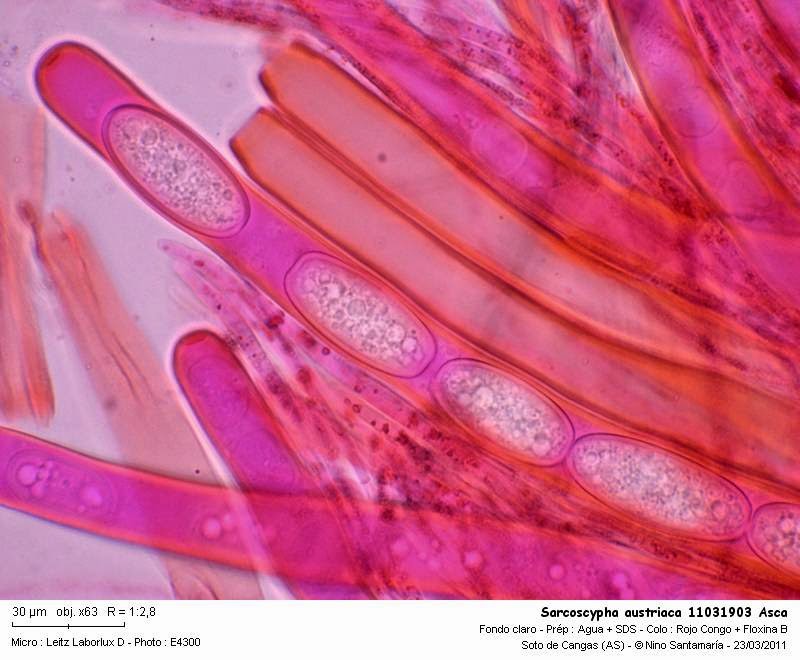 Fly Shadows.: Accidente en el género Sarcoscypha.