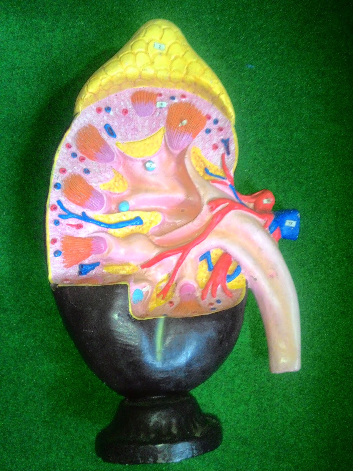 SISTEM EKSKRESI PADA MANUSIA (Ginjal, Hati, Paru-Paru dan Kulit)