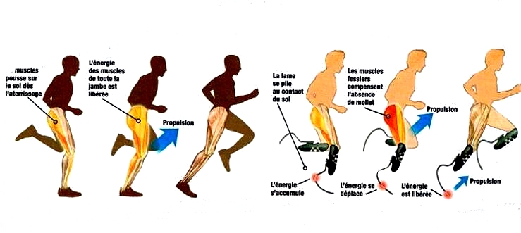 Les prothèses sportives