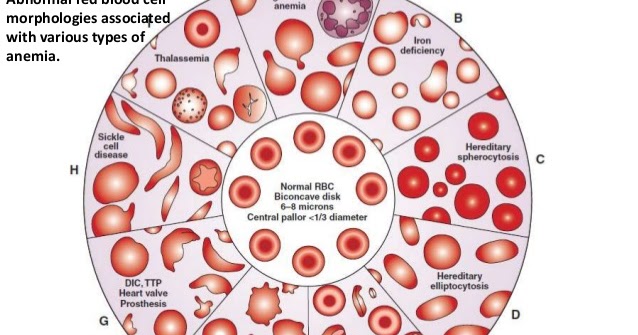 Lecture Notes in Medical Technology: Lecture #8: Red Blood Cell Disorders