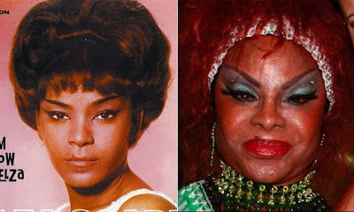 Quinta-Feira 12: Famosas que colocaram botox - veja o antes e depois