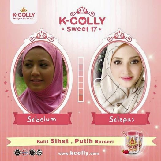 Anis Beautycare: K-Colly Sweet 17 Murah RM81 PROMOSI