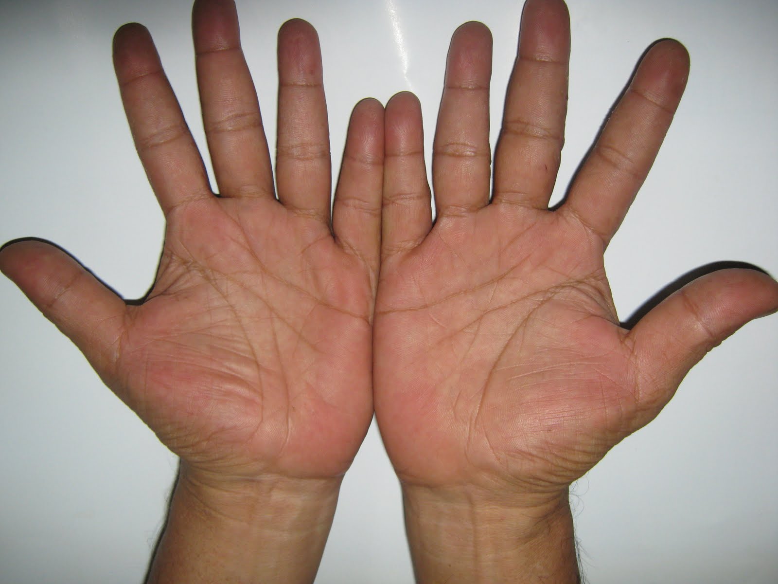 Perbezaan Saiz Tapak Tangan