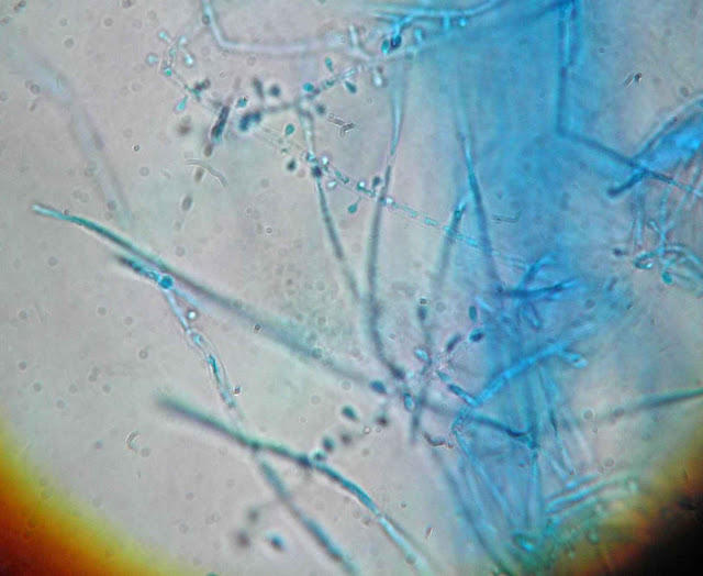 ATLAS MICOLOGIA: TRICHOPHYTON INTERDIGITALE