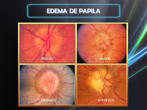 POSTGRADO DE NEUROCIRUGÍA - HOSPITAL CENTRAL DE MARACAY - VENEZUELA ...