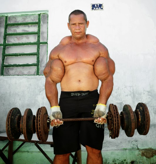 Welcome to Samuel Edosa's Blog: Photo : Meet The Man who has Injected ...