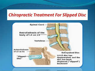 TIPS KEWANGAN TAKAFUL & HIBAH FOR ALL FOR LIFE: RAWATAN ALTERNATIF ...