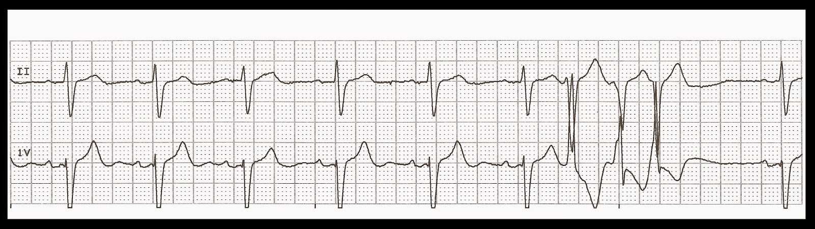 Practice EKG Strips 392