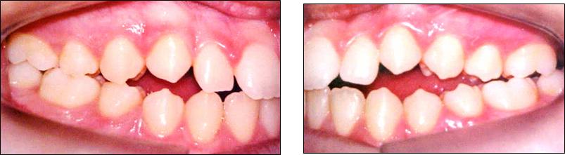 Curso de Ortodontia APCD Pinheiros