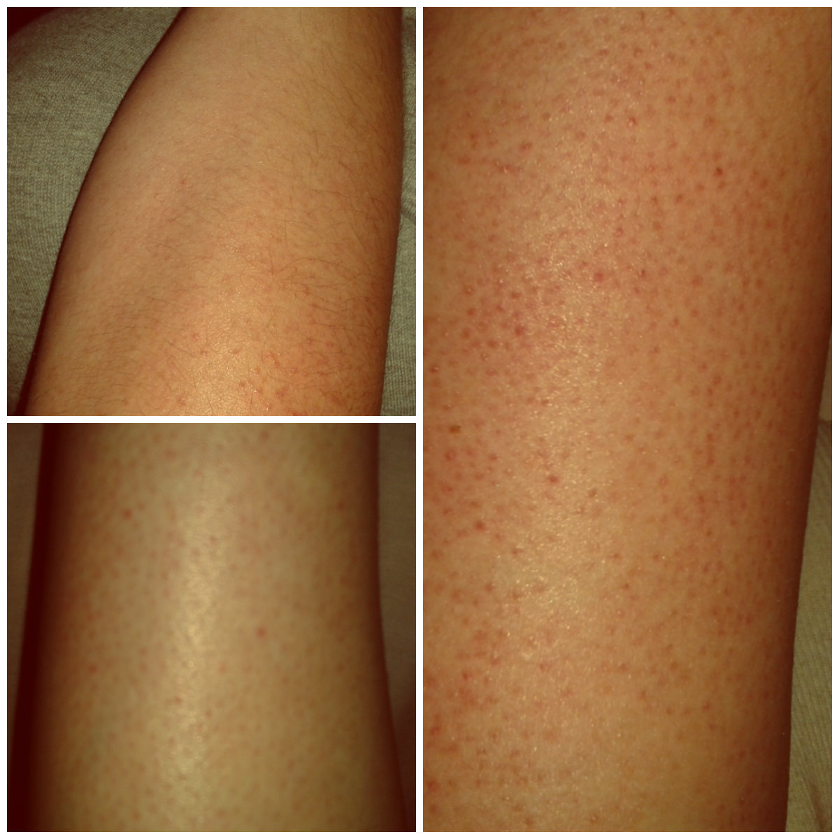 belfastcitygal: Week one: DERMAdoctor KP duty scrub and moisturiser