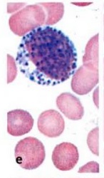 FICHERO HEMATOLOGIA : Mielocito basófilo