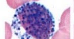 FICHERO HEMATOLOGIA : Mielocito basófilo