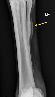 Michael Porter, Equine Veterinarian: Not All Splints Are Created Equal!!