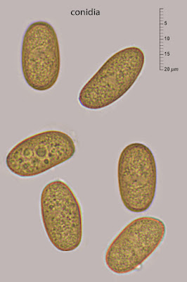 Diplodia seriata De Not. • CEMAS Hongo patógeno, Malus sylvestris