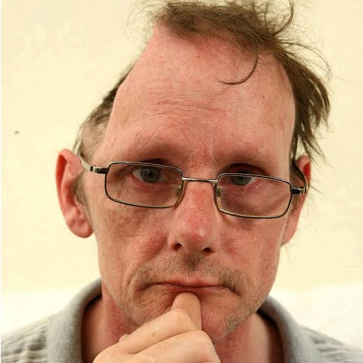 Man with half-head complains after his ?195 a week benefits is slashed ...