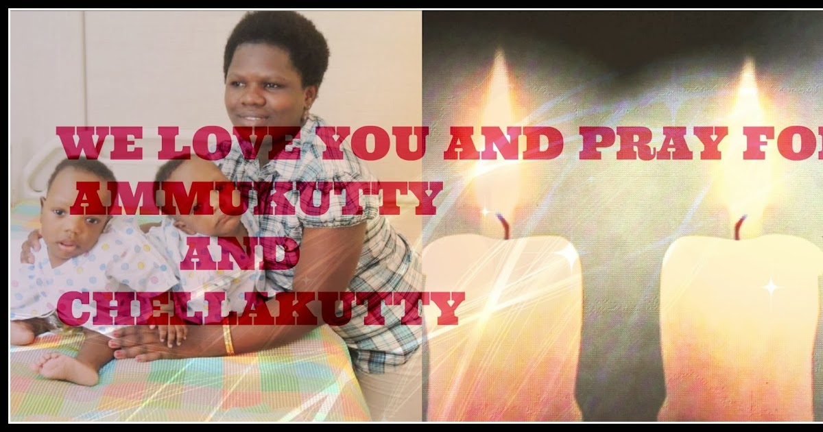 Being Daryl: Surgical Separation of Pygopagus twins at Apollo Children ...