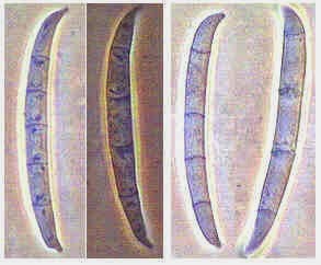 Anything and Everything: Fusarium – Identification Characters and Plant ...