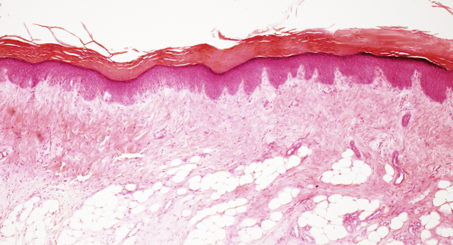 Histología - Fisioterapia IIIB: Piel