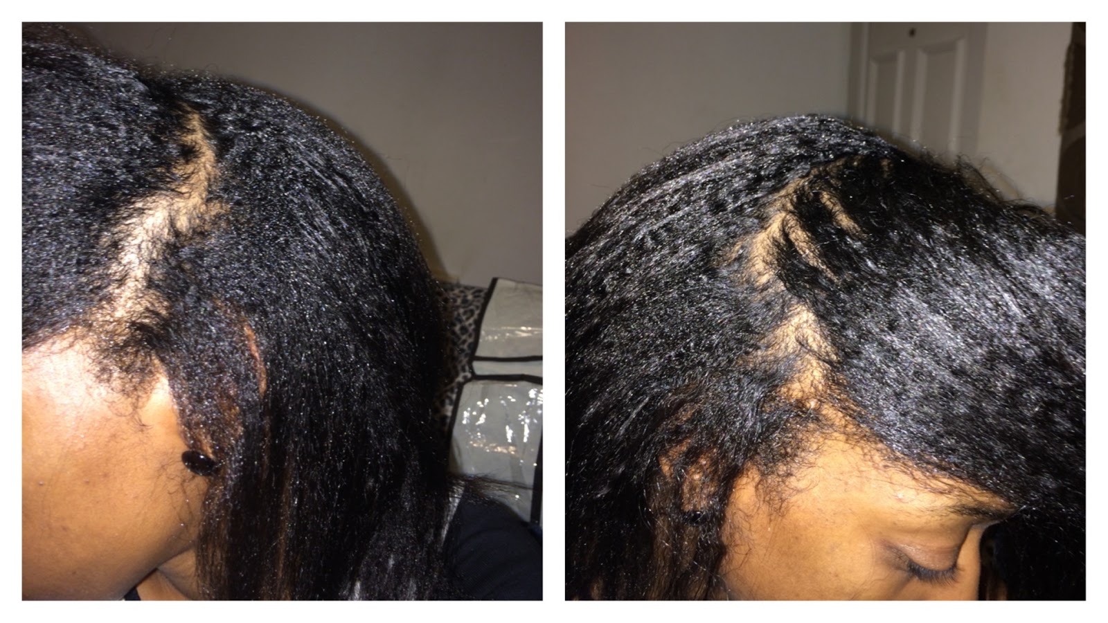 The Healthy Hair Diary: Recovering from a Major Setback!