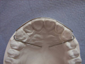 Dentistry and Medicine: Retention of removable Orthodontic appliences