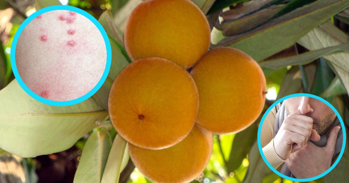 Health Benefits of Mabolo