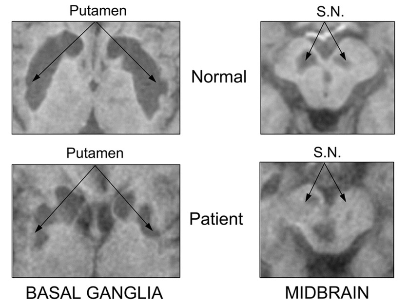 The Neurocritic: November 2015