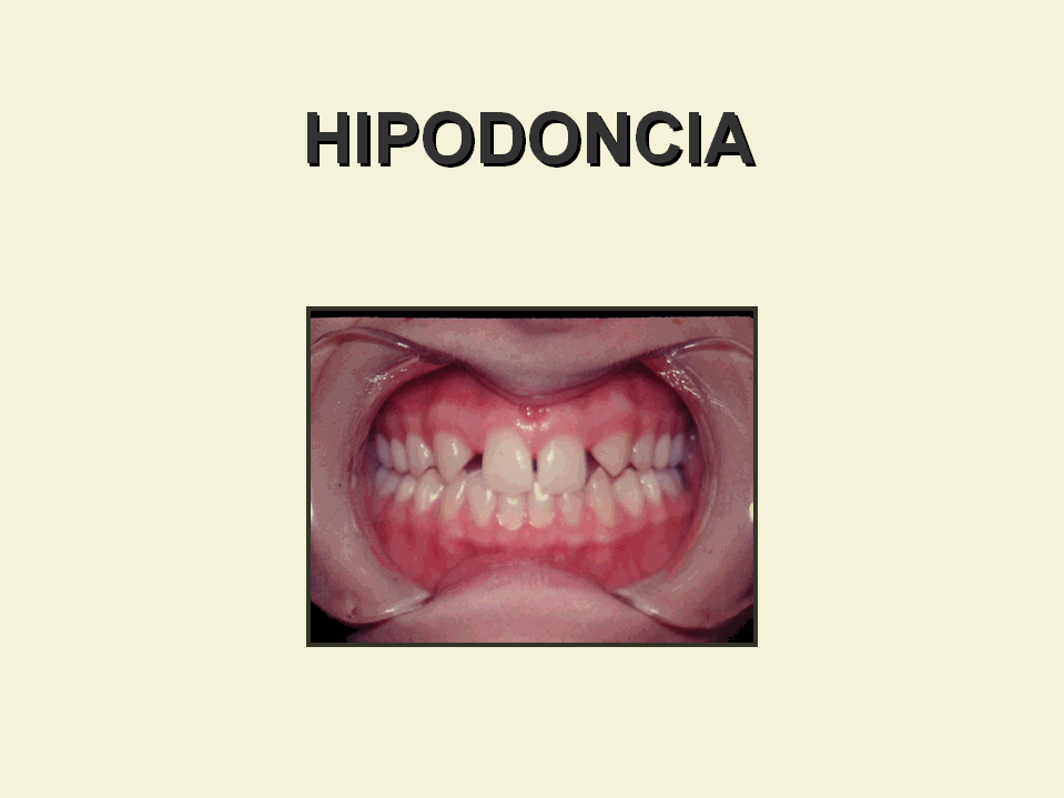 ANOMALIAS DENTALES - Mind Map