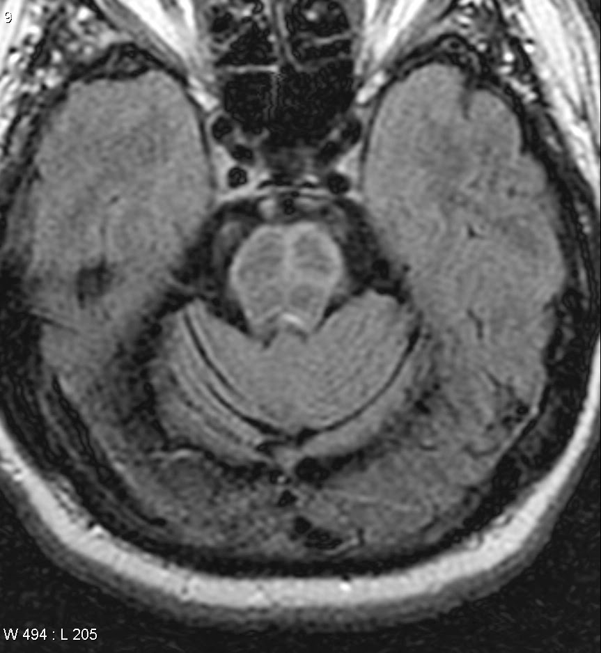 Medical Treatment Pictures-for Better Understanding: Multiple System ...
