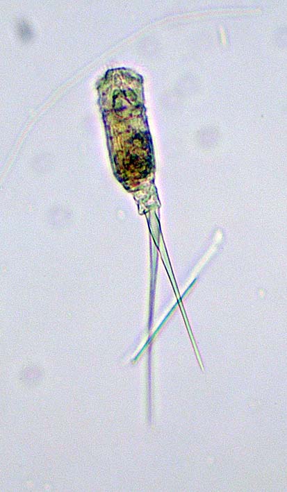 Beyond the Human Eye: Life in 10 Drops of Water: Assorted Protists and ...