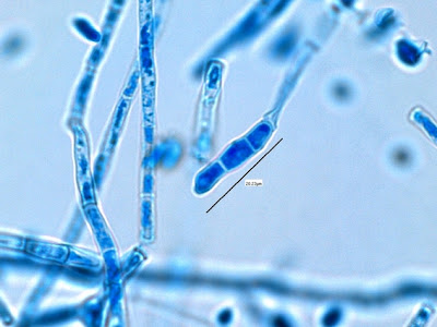 Fun With Microbiology (What's Buggin' You?): Trichophyton tonsurans