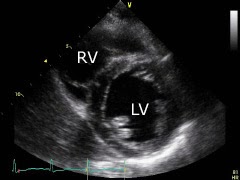 ER goldbook: Basic Echocardiography in ER