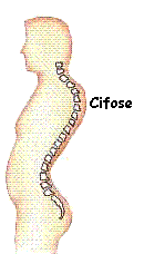 CIÊNCIAS NA ESTEFANA: SAÚDE DA COLUNA VERTEBRAL