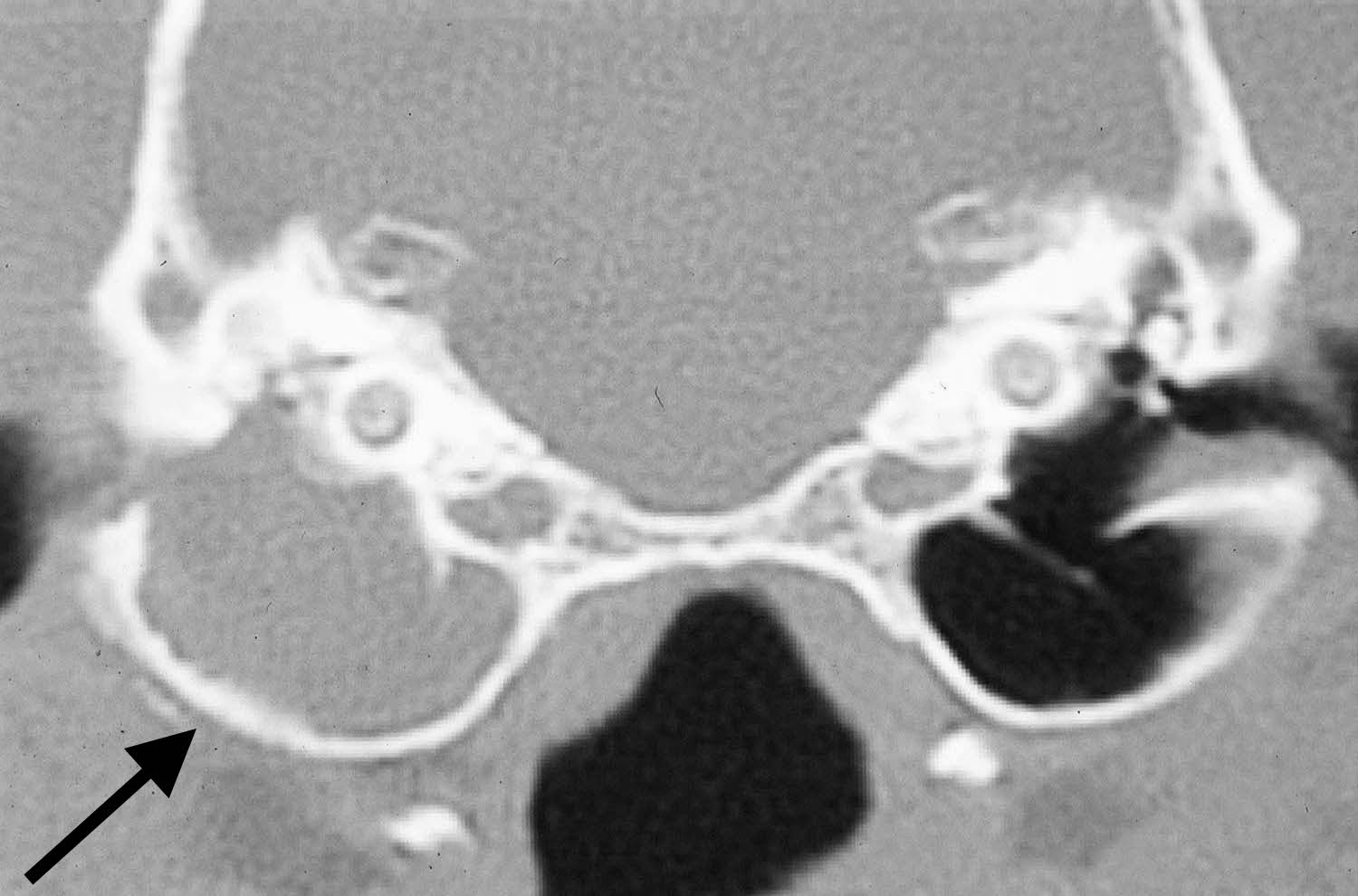 Veterinary Key Points: Nasopharyngeal Polyps in Cats: Key words ...