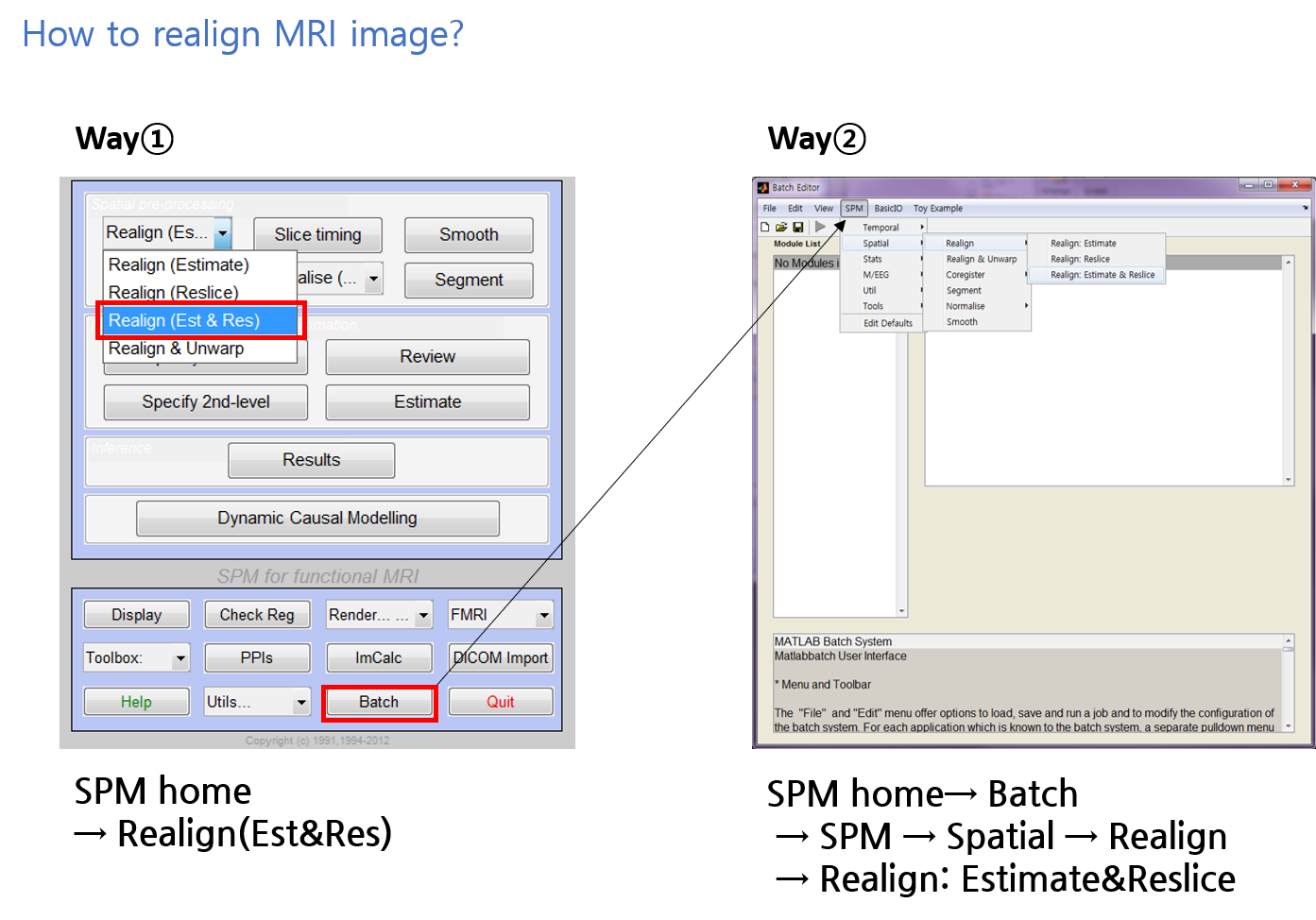 SPM을 이용한 뇌영상 전처리(1): Realignment