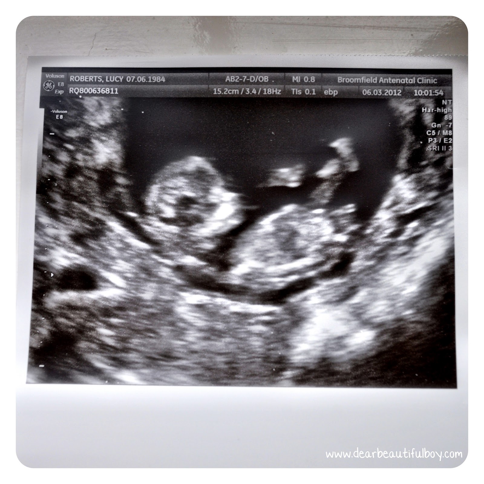 the dating scan - dear beautiful {a family lifestyle blog}